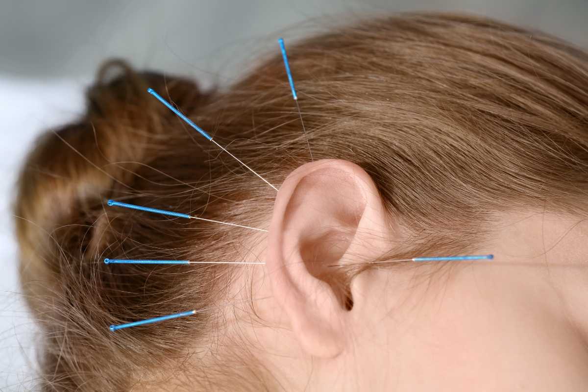 Ear Acupuncture Points for Anxiety