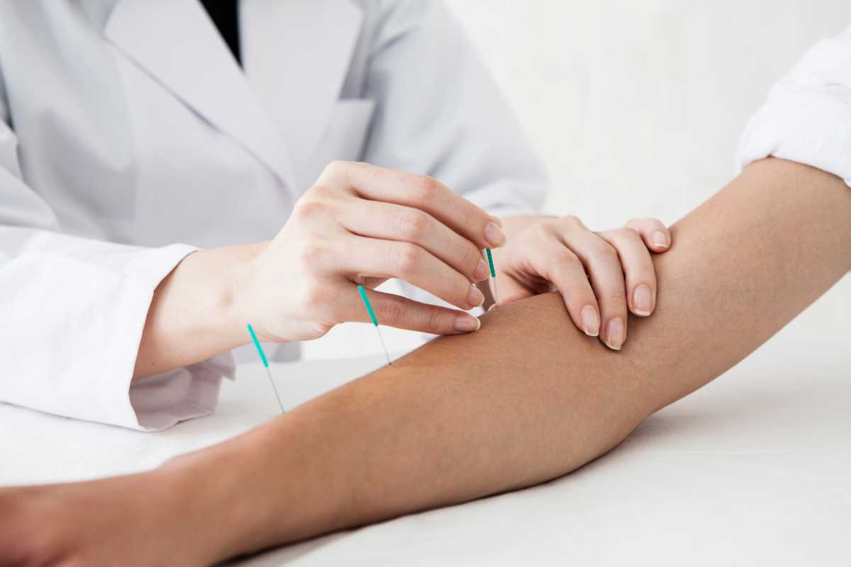 Can Acupuncture Cause Nerve Damage? Debunking Myths