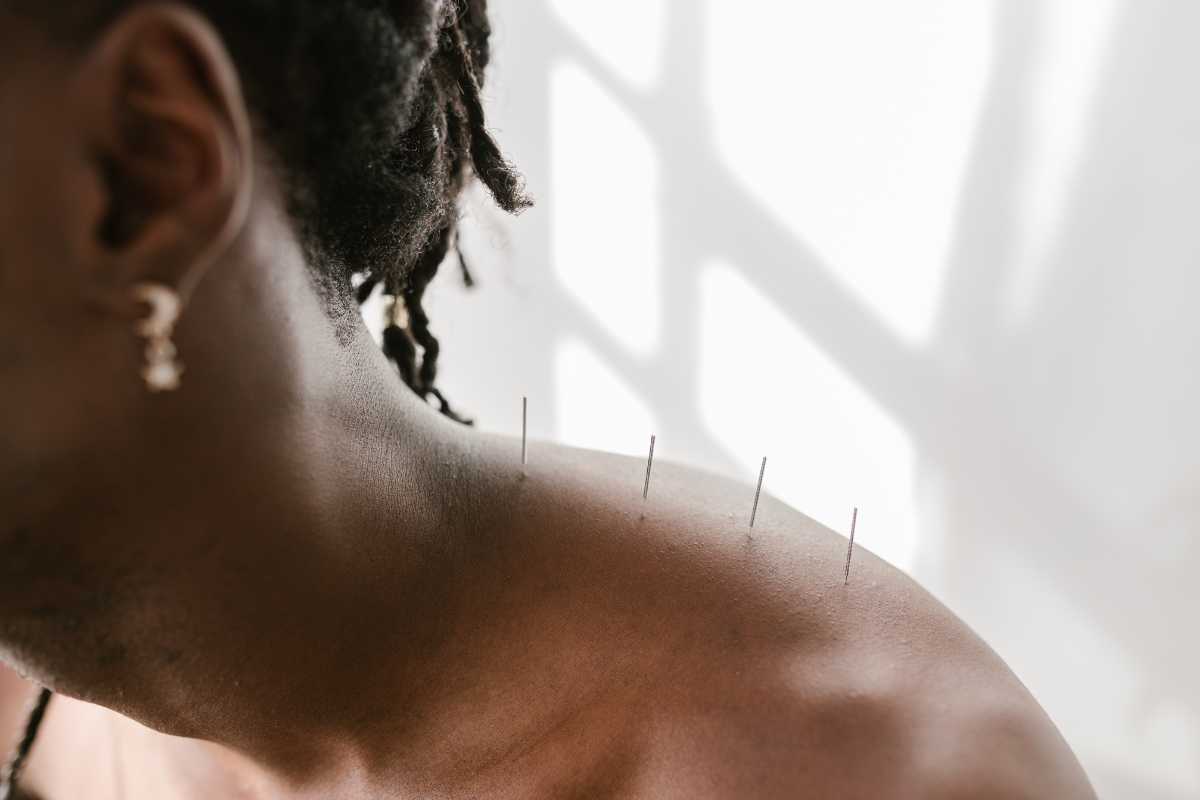 Top 5 Shoulder Acupuncture Points