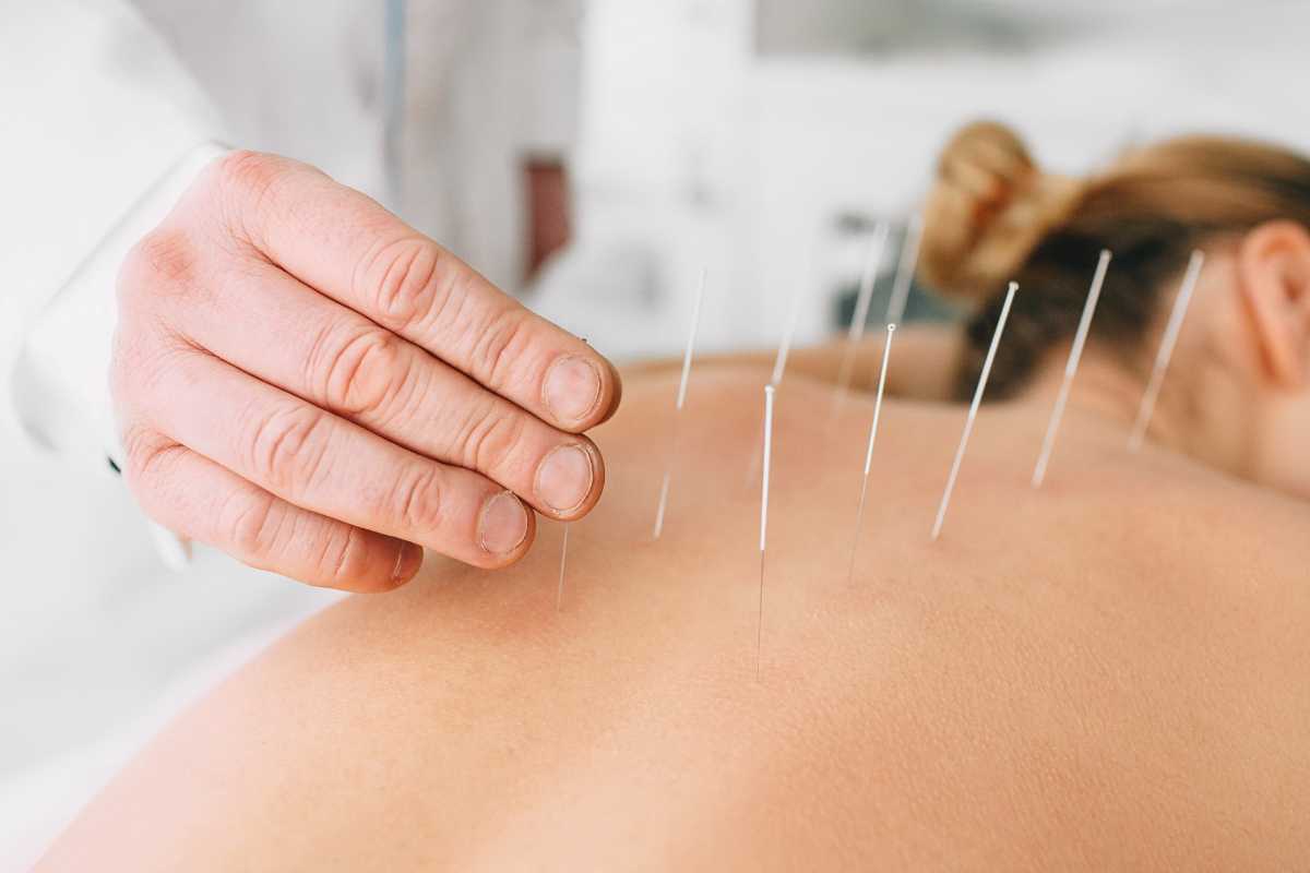 Acupuncture Migraine Treatment Cost: The 2024 Pricing Guide