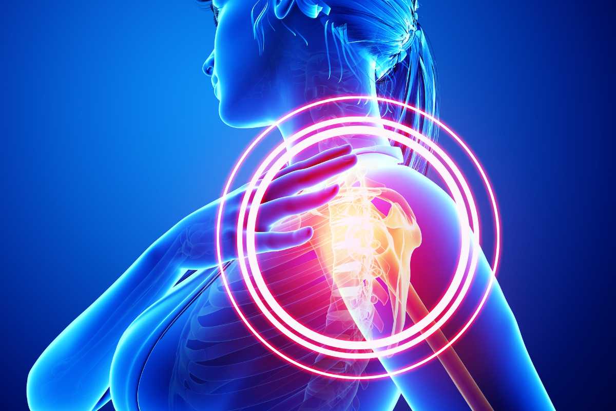 Top 5 Shoulder Acupuncture Points