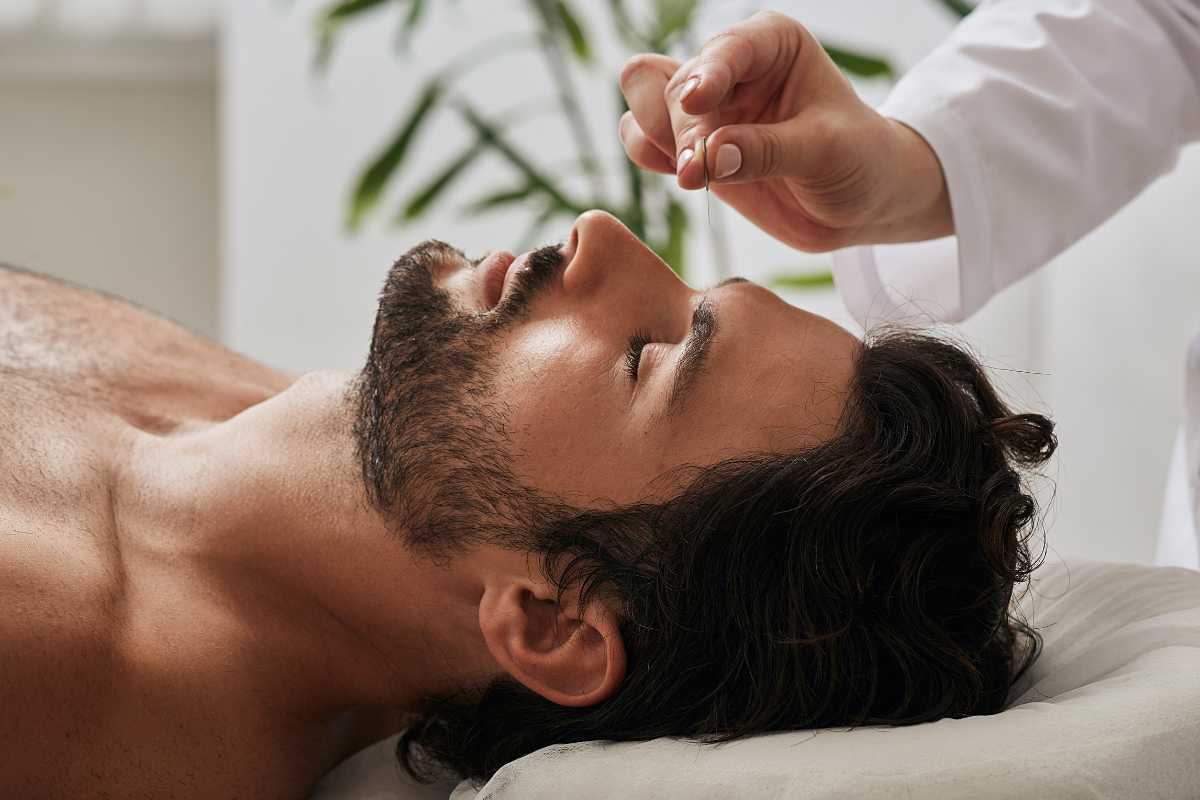 Acupuncture Migraine Protocol: Guidelines
